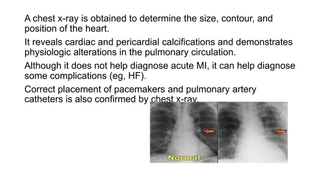 non invasive and invasive cardiac monitoring.pptx
