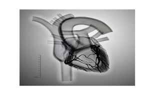 non invasive and invasive cardiac monitoring.pptx