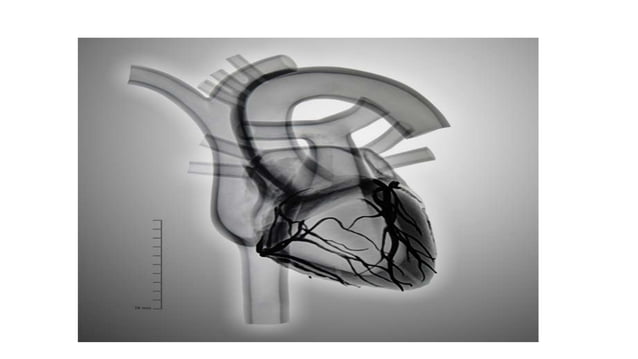 non invasive and invasive cardiac monitoring.pptx
