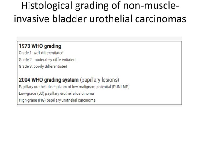 Non invasive bladder growth | PPTX | Cancer | Diseases and Conditions