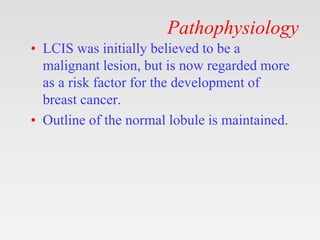 Non invasive breast cancer.pptx