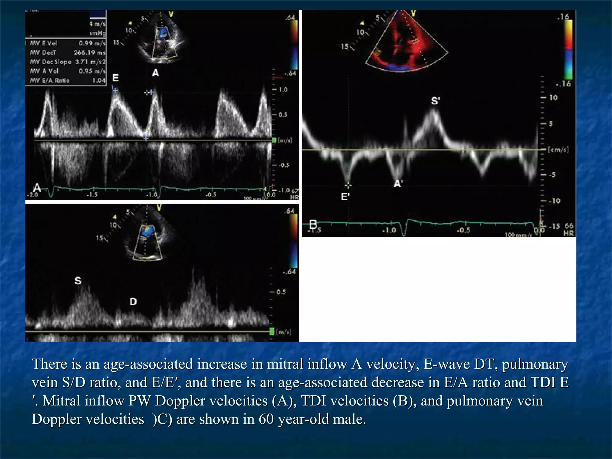 Non invasive diagnosis of hf | PPT