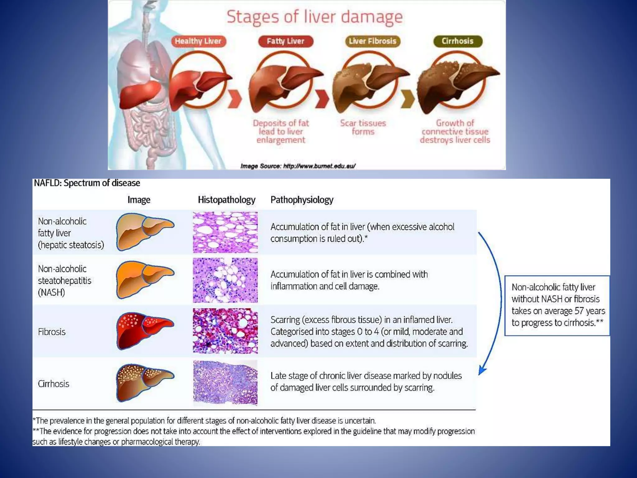Non invasive modalities for diagnosis of NAFLD | PPT