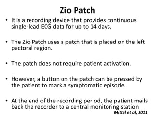 Non invasive evaluation of arrhythmias | PPTX | Heart and ...