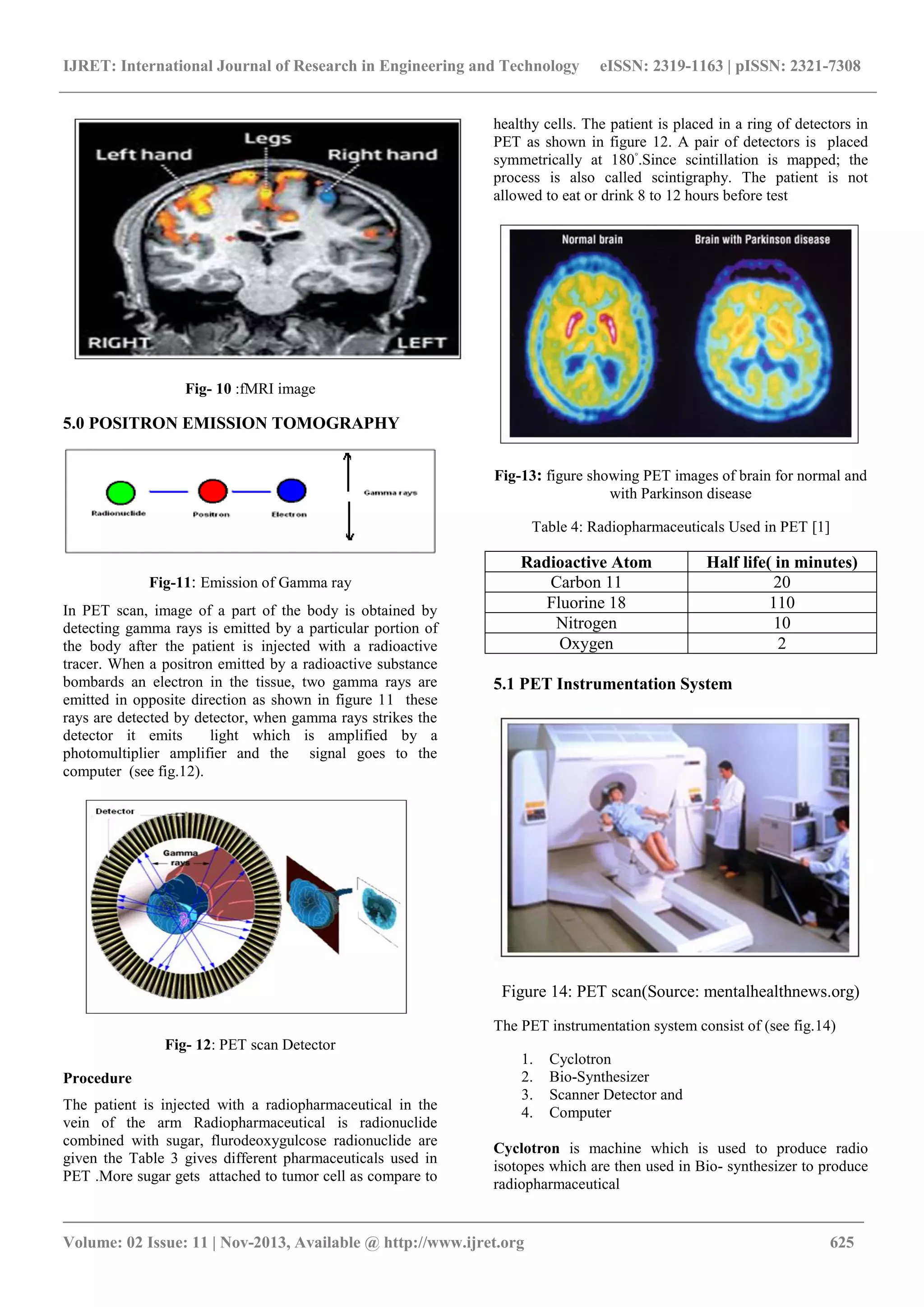 Non invasive modalities of neurocognitive science used for brain mapping | PDF