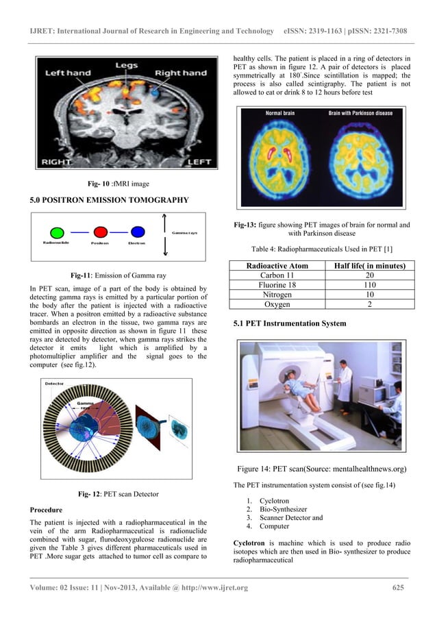 Non invasive modalities of neurocognitive science used for brain mapping | PDF