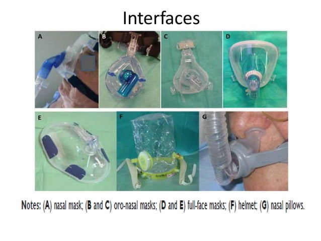 Non invasive ventilation.pdf