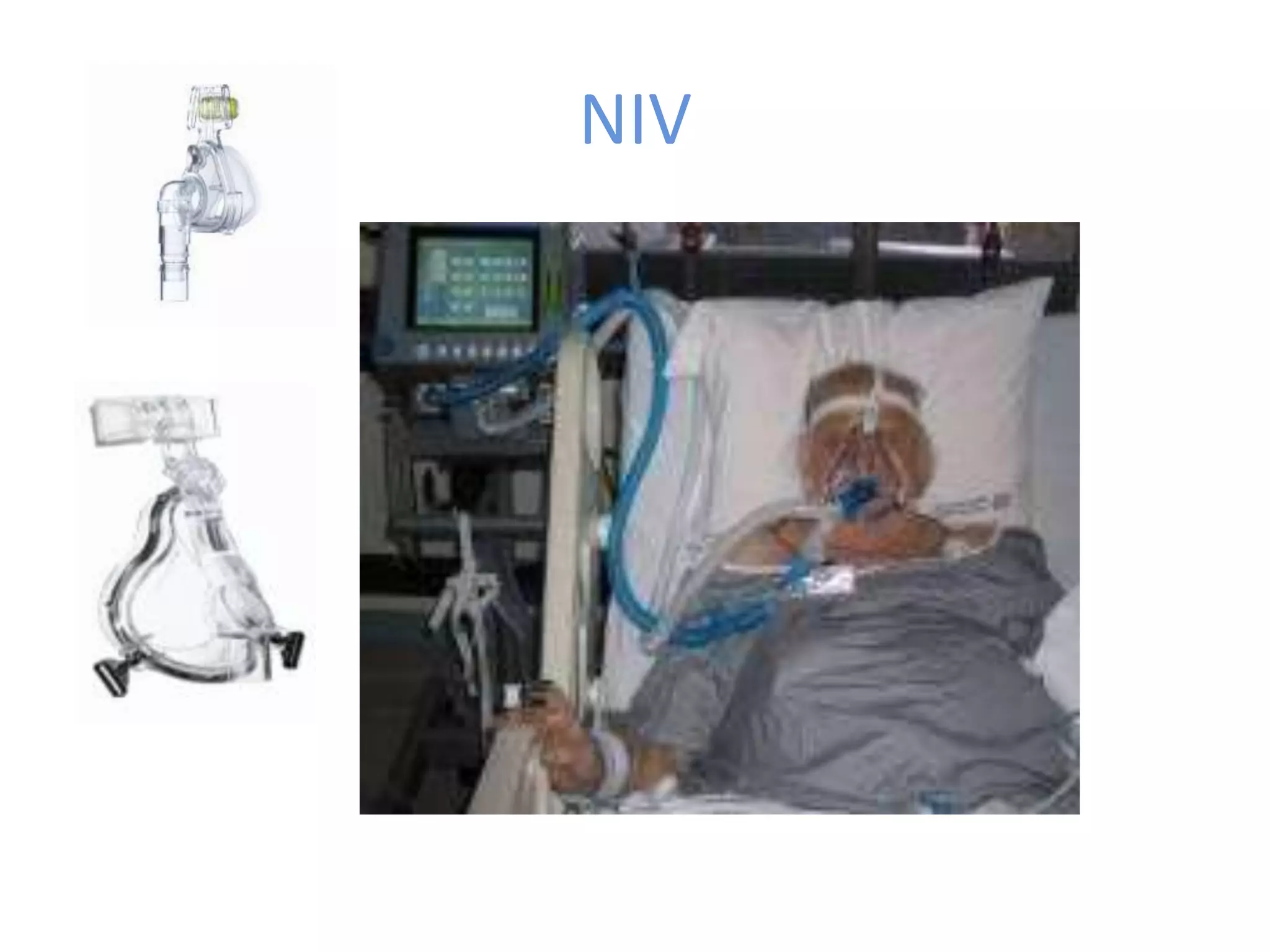 Non invasive ventilations | PPT