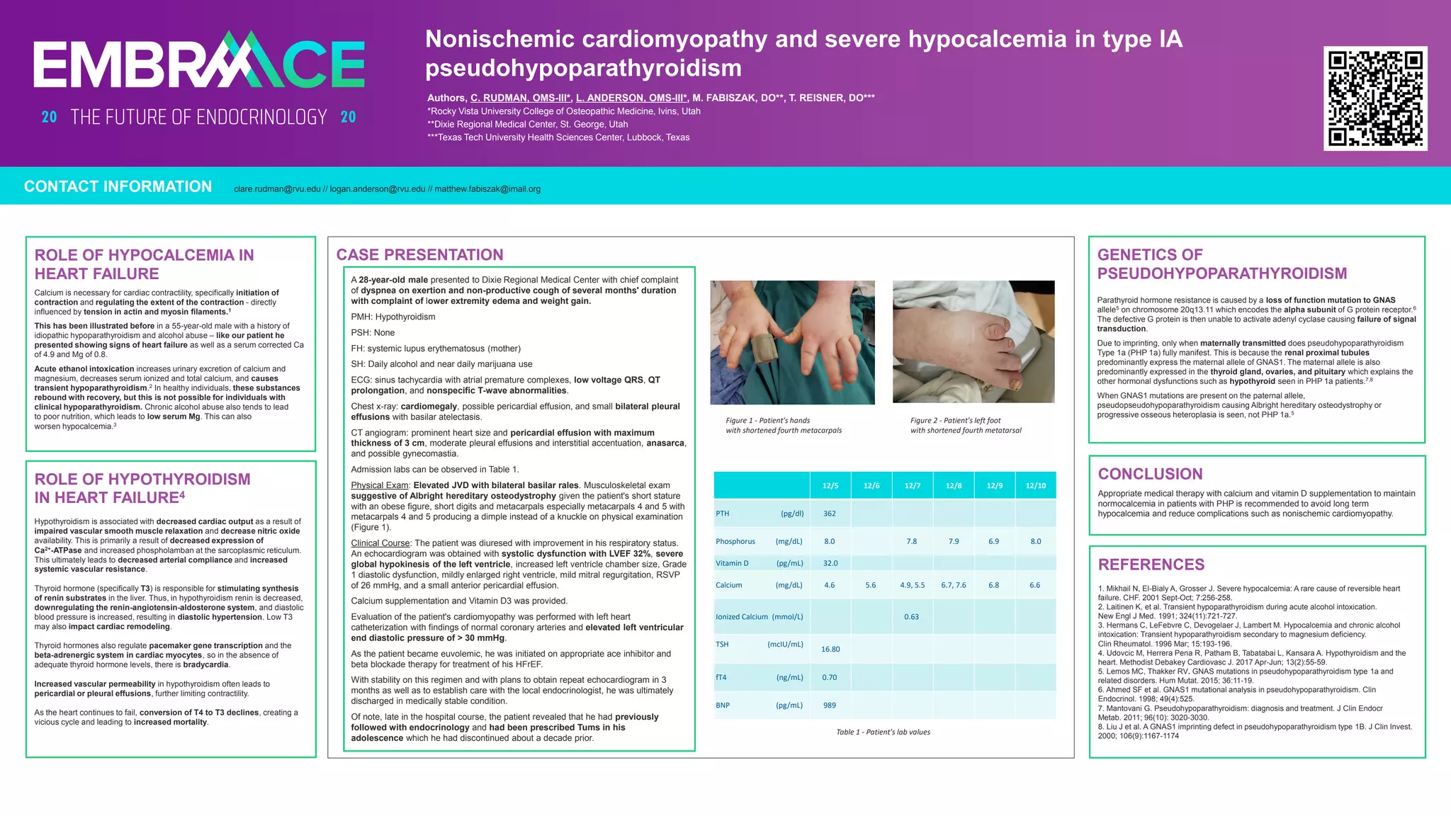 Nonischemic Cardiomyopathy and Severe Hypocalcemia in Type 1A ...