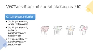 Nonlocking vs Locking Tibial Plateau Fractures.pptx