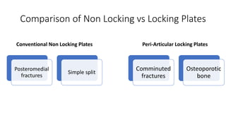 Nonlocking vs Locking Tibial Plateau Fractures.pptx