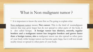 Non malignant tumor.pptx
