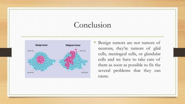 Non malignant tumor.pptx | Brain and Nervous System Disorders ...