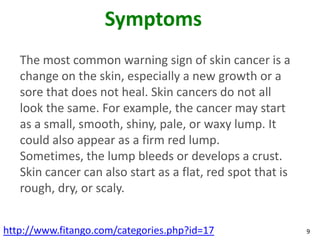 Non-Melanoma Skin Cancer | PPTX