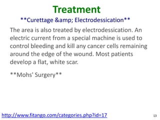 Non-Melanoma Skin Cancer | PPTX