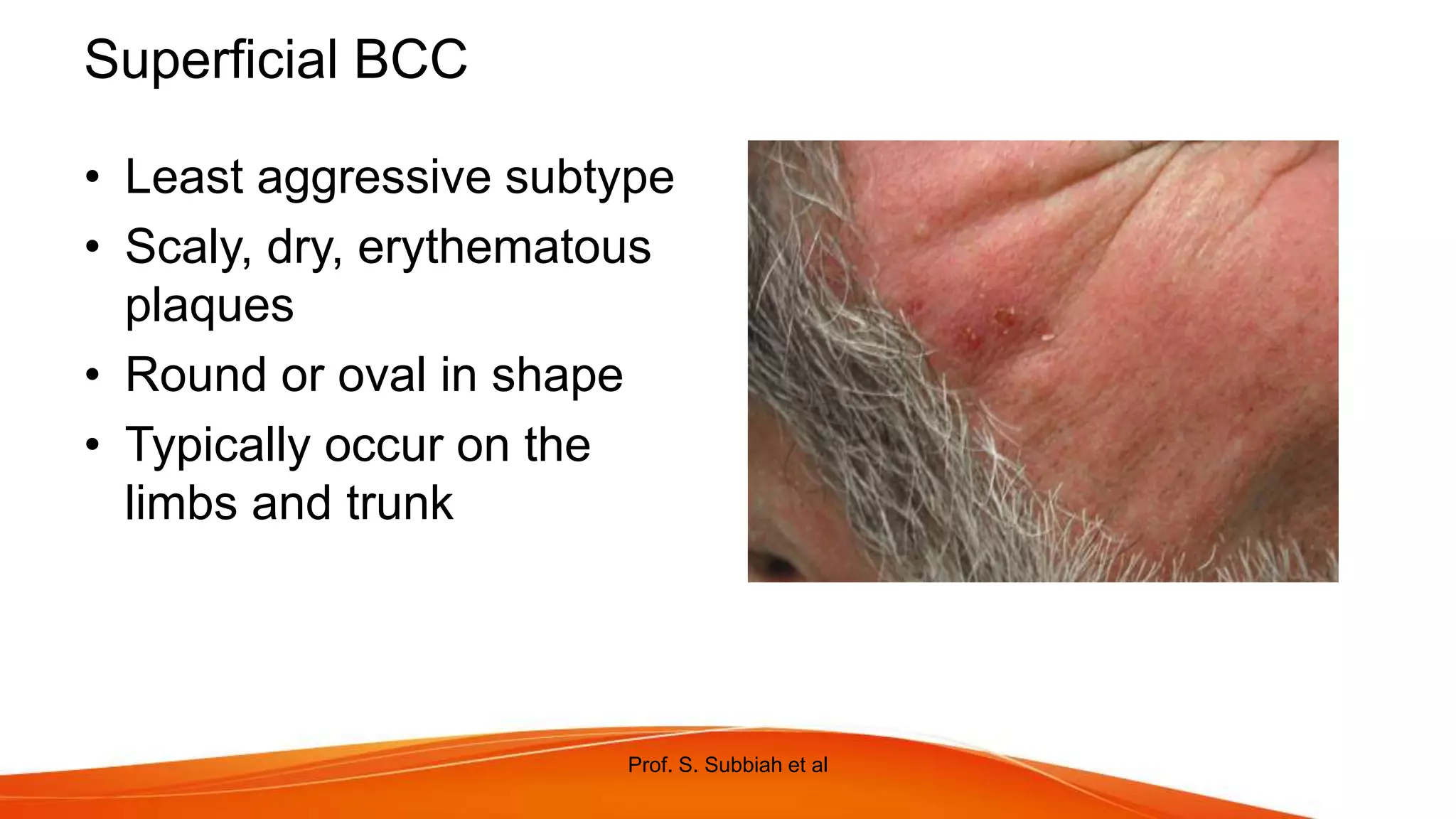 NON MELANOMA SKIN CANCERS IN HEAD AND NECK.pptx