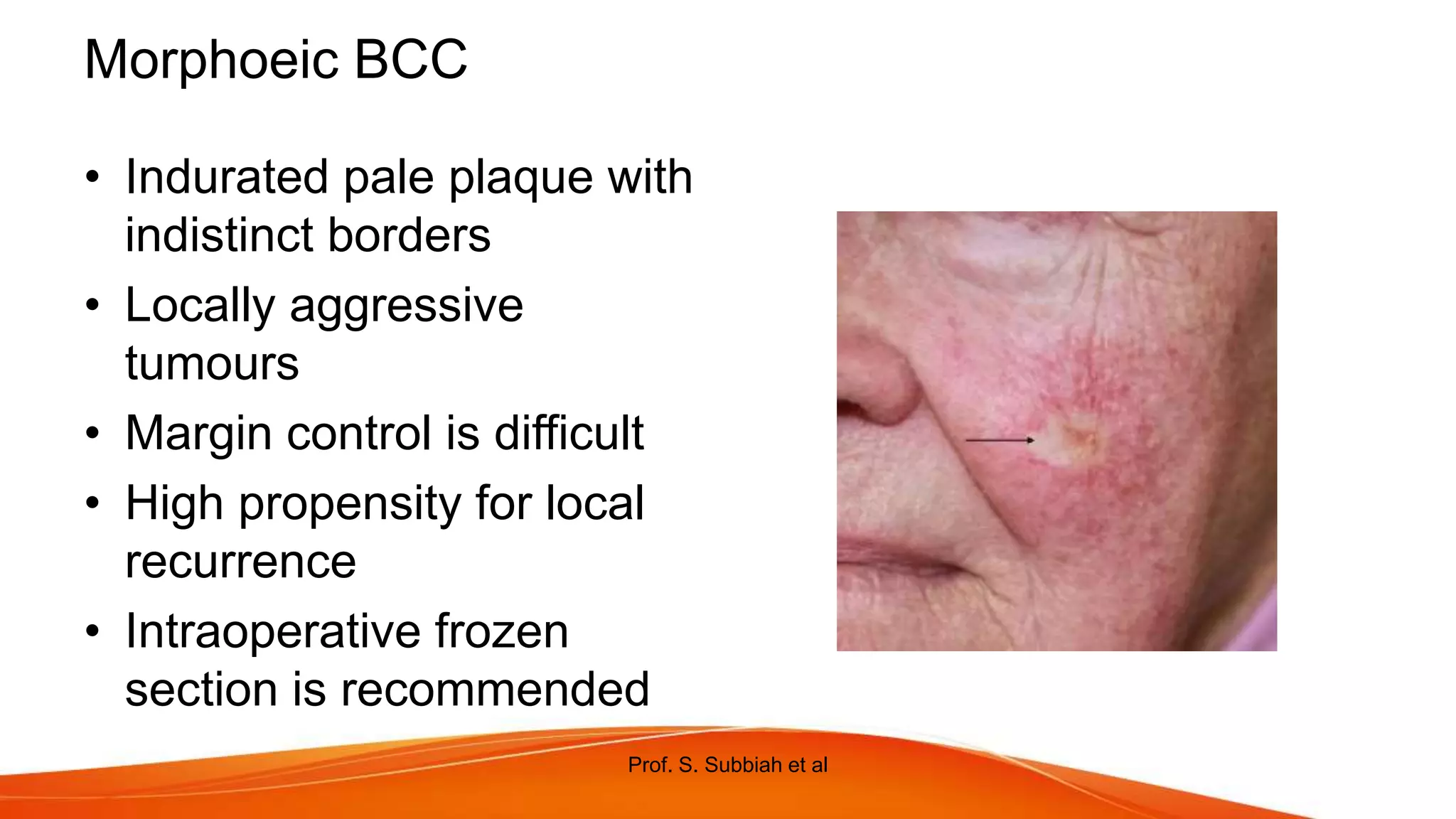 NON MELANOMA SKIN CANCERS IN HEAD AND NECK.pptx