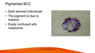 NON MELANOMA SKIN CANCERS IN HEAD AND NECK.pptx
