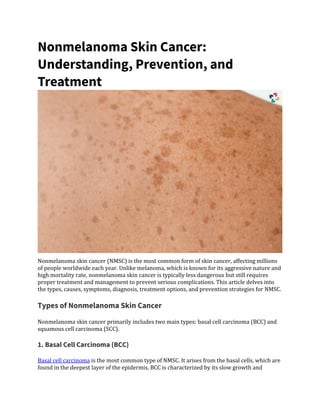 Nonmelanoma Skin Cancer: Types, Causes, Symptoms and Treatment | The ...