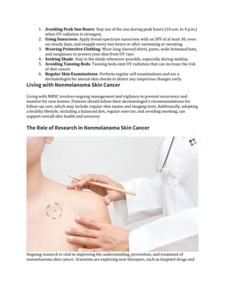 Nonmelanoma Skin Cancer: Types, Causes, Symptoms and Treatment | The ...