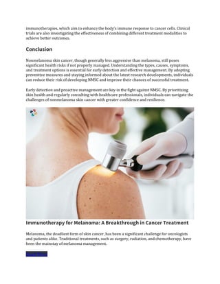 Nonmelanoma Skin Cancer: Types, Causes, Symptoms and Treatment | The ...