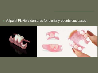 Non-metal clasp removable partial dentures using CAD CAM | PPTX