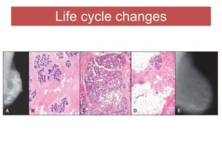 Non neoplastic breast lesions | PPTX