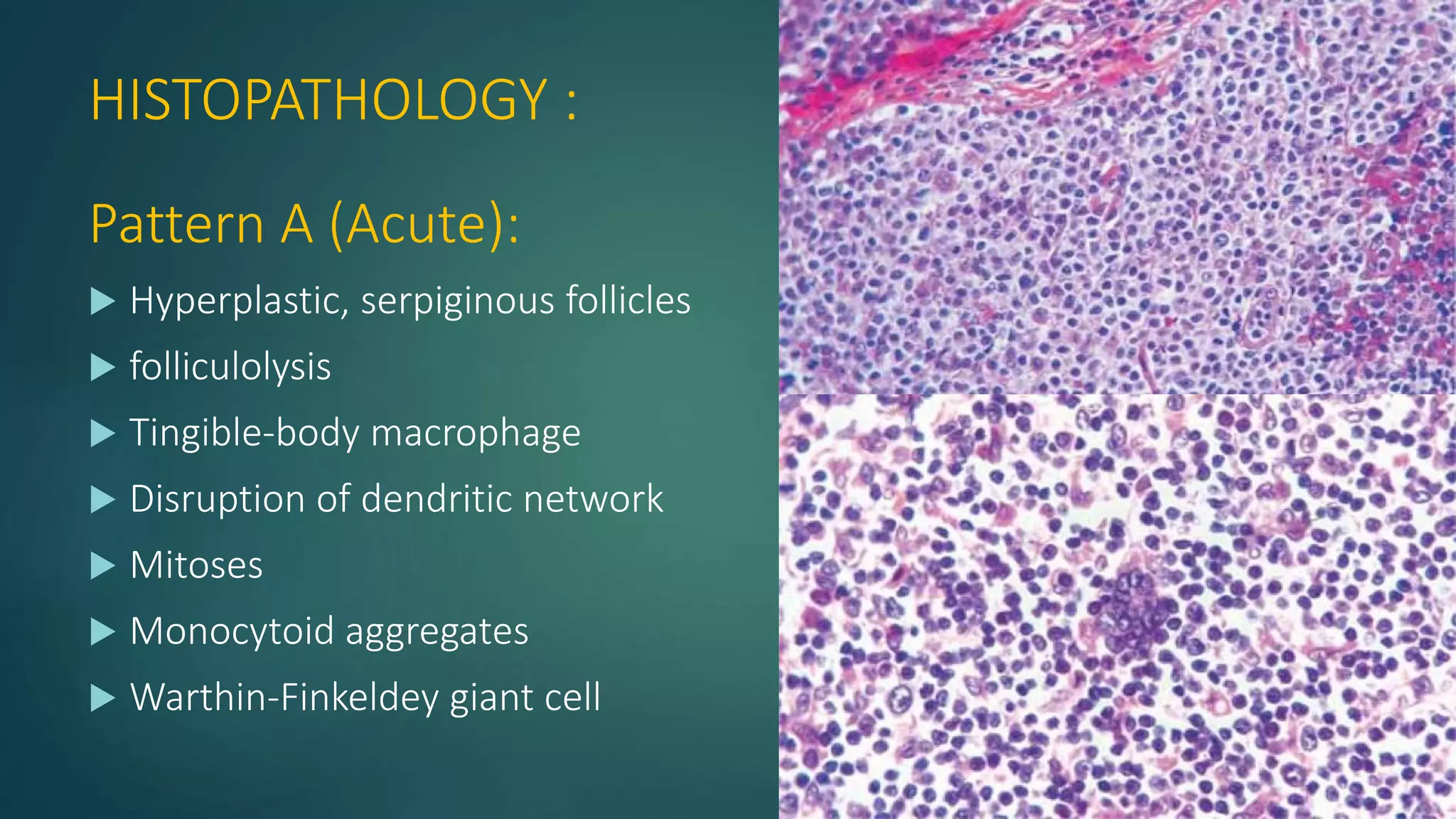 Non neoplastic lymphadenopathy | PPTX