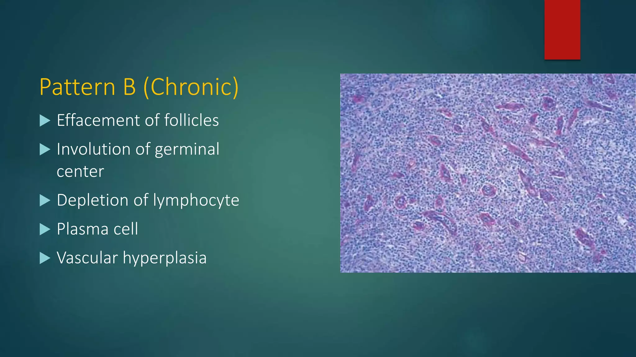 Non neoplastic lymphadenopathy | PPTX