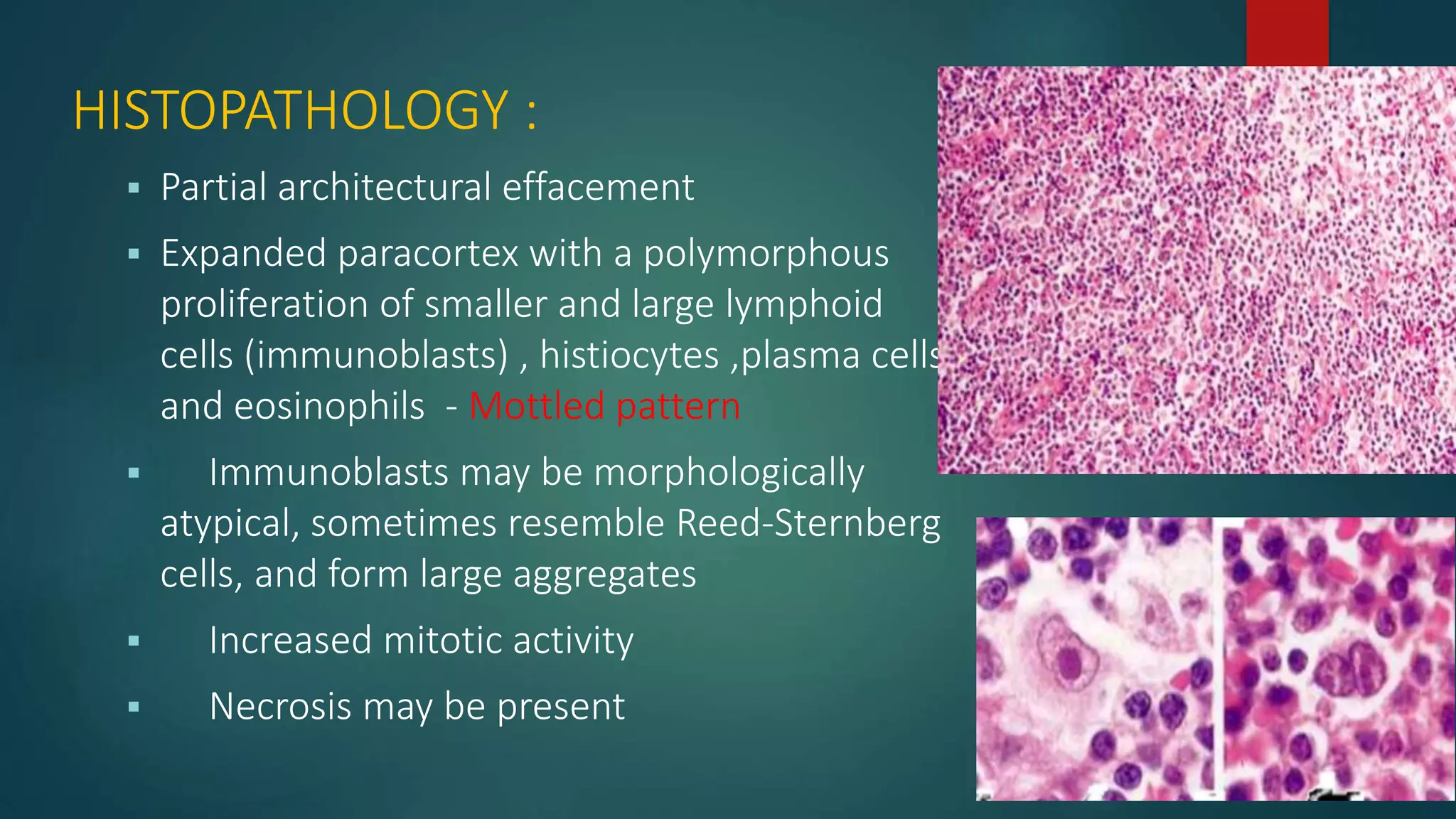 Non neoplastic lymphadenopathy | PPTX