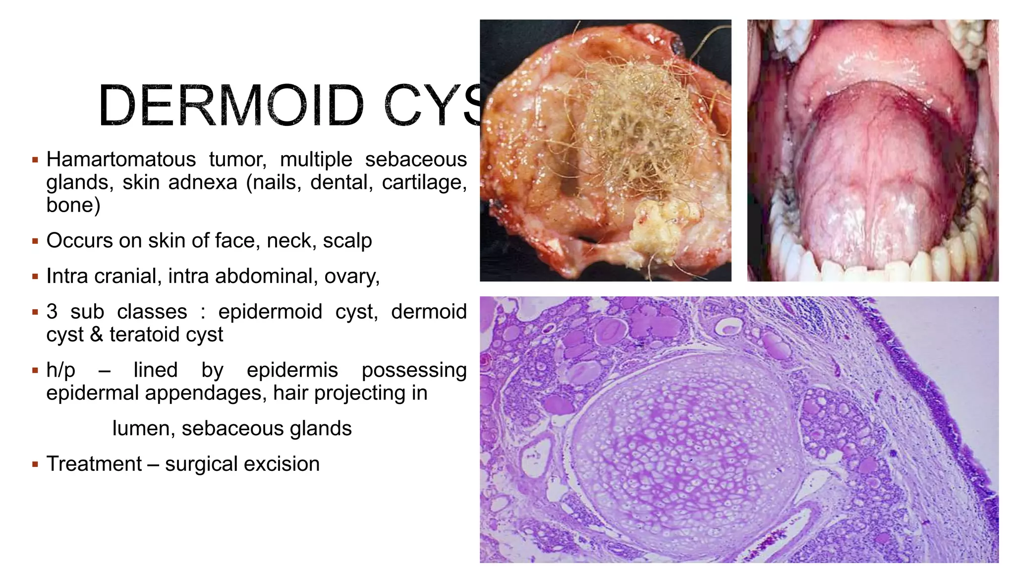 Non odontogenic cyst | PPTX