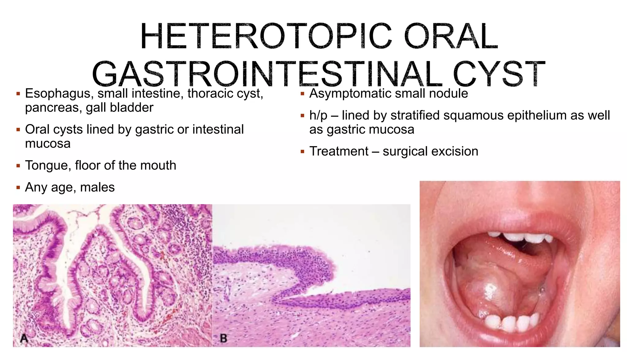 Non odontogenic cyst | PPTX