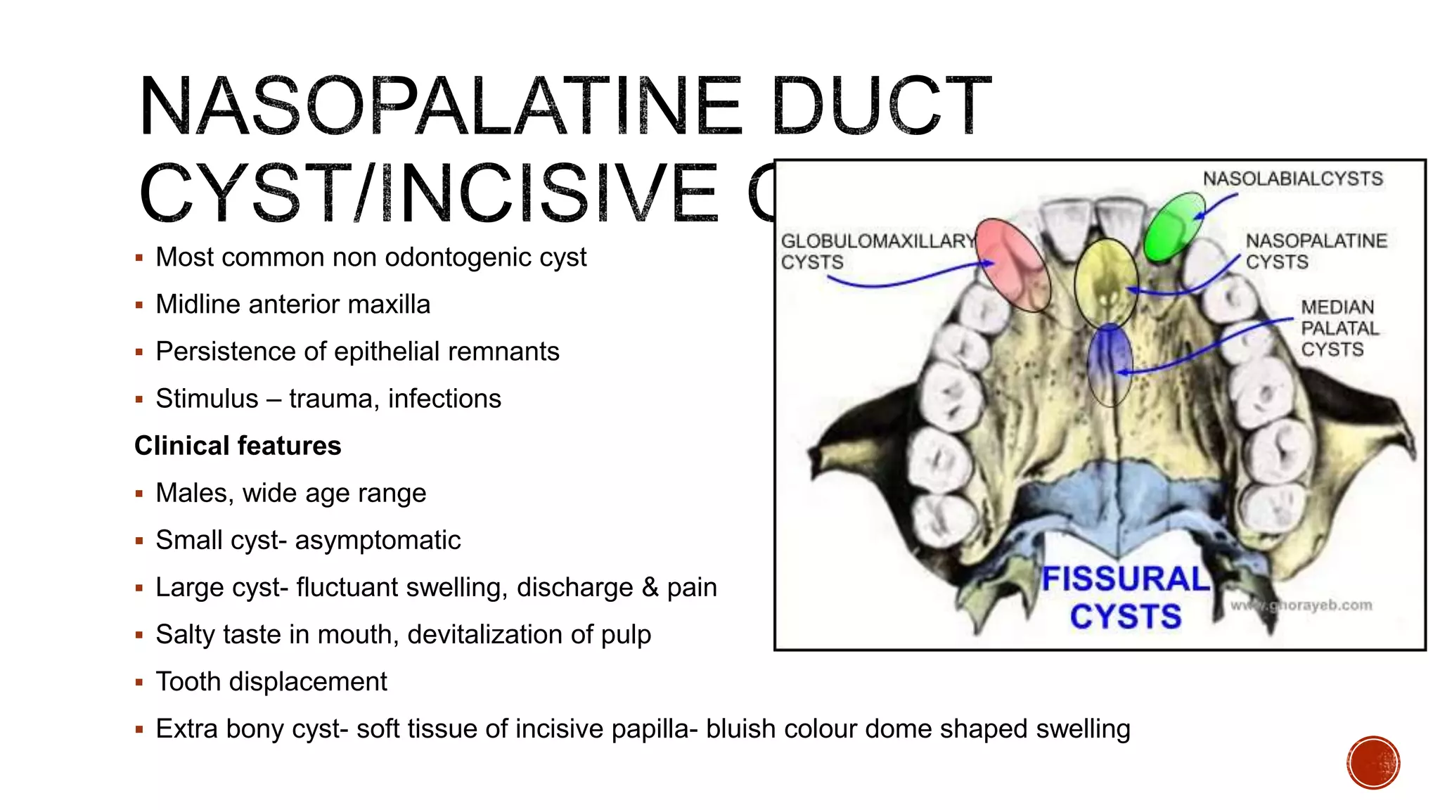 Non odontogenic cyst | PPTX