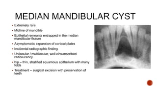 Median Mandibular Cyst