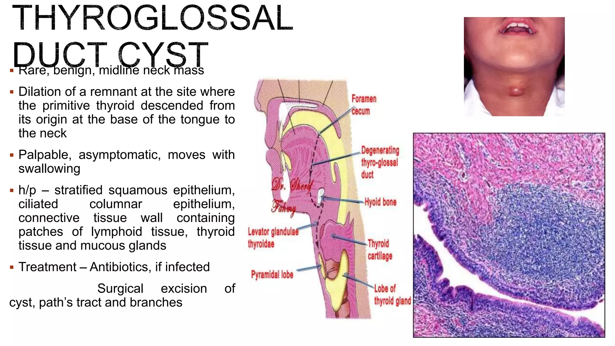 Non odontogenic cyst | PPTX | Thyroid Disorders | Endocrine and ...