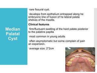 non odontogenic cysts, classification ex | PPT