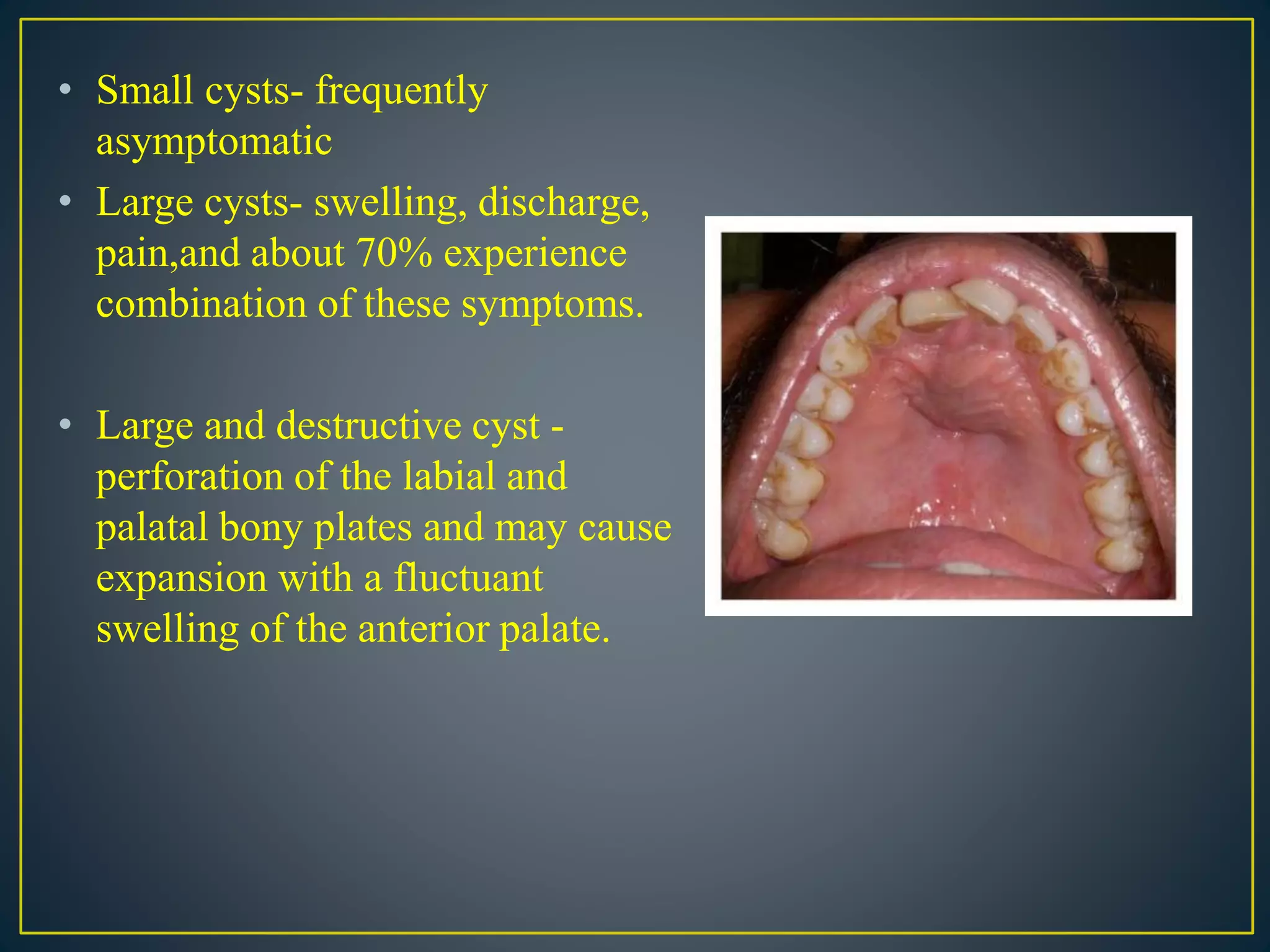 Non odontogenic cyst and pseudo cyst of the jaw- seminar 2- ORIGINAL.pptx