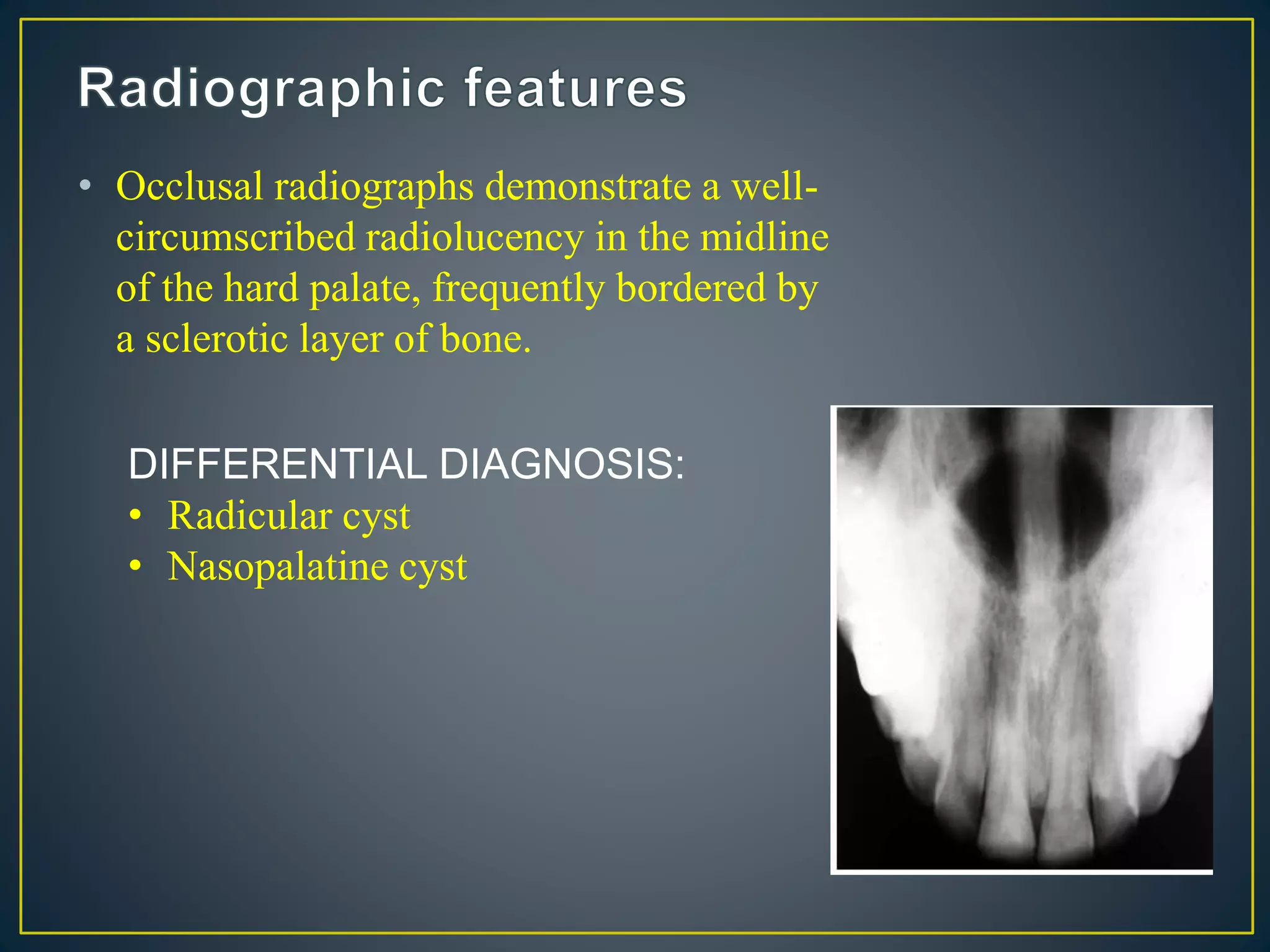 Non odontogenic cyst and pseudo cyst of the jaw- seminar 2- ORIGINAL.pptx