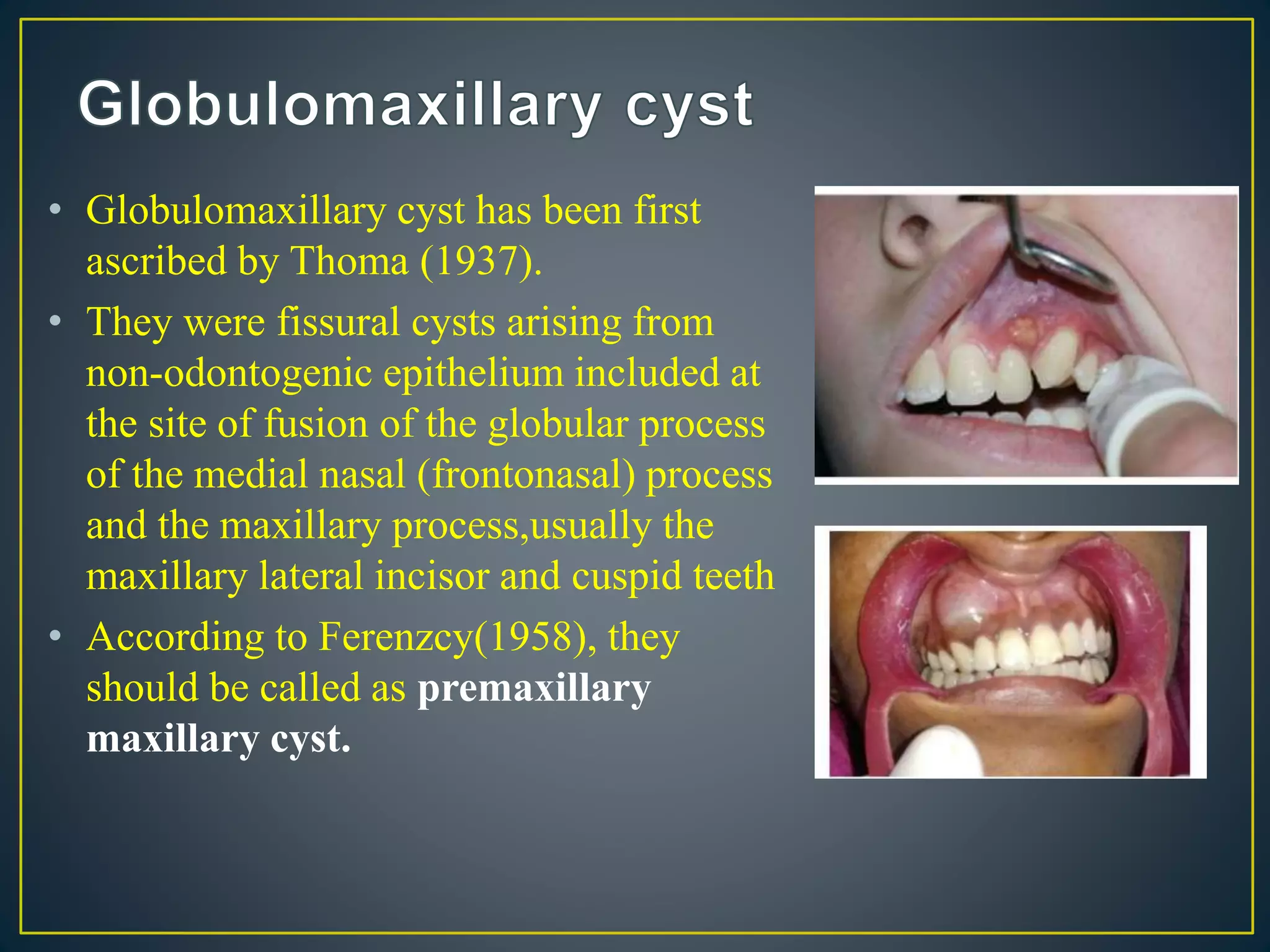 Non odontogenic cyst and pseudo cyst of the jaw- seminar 2- ORIGINAL.pptx