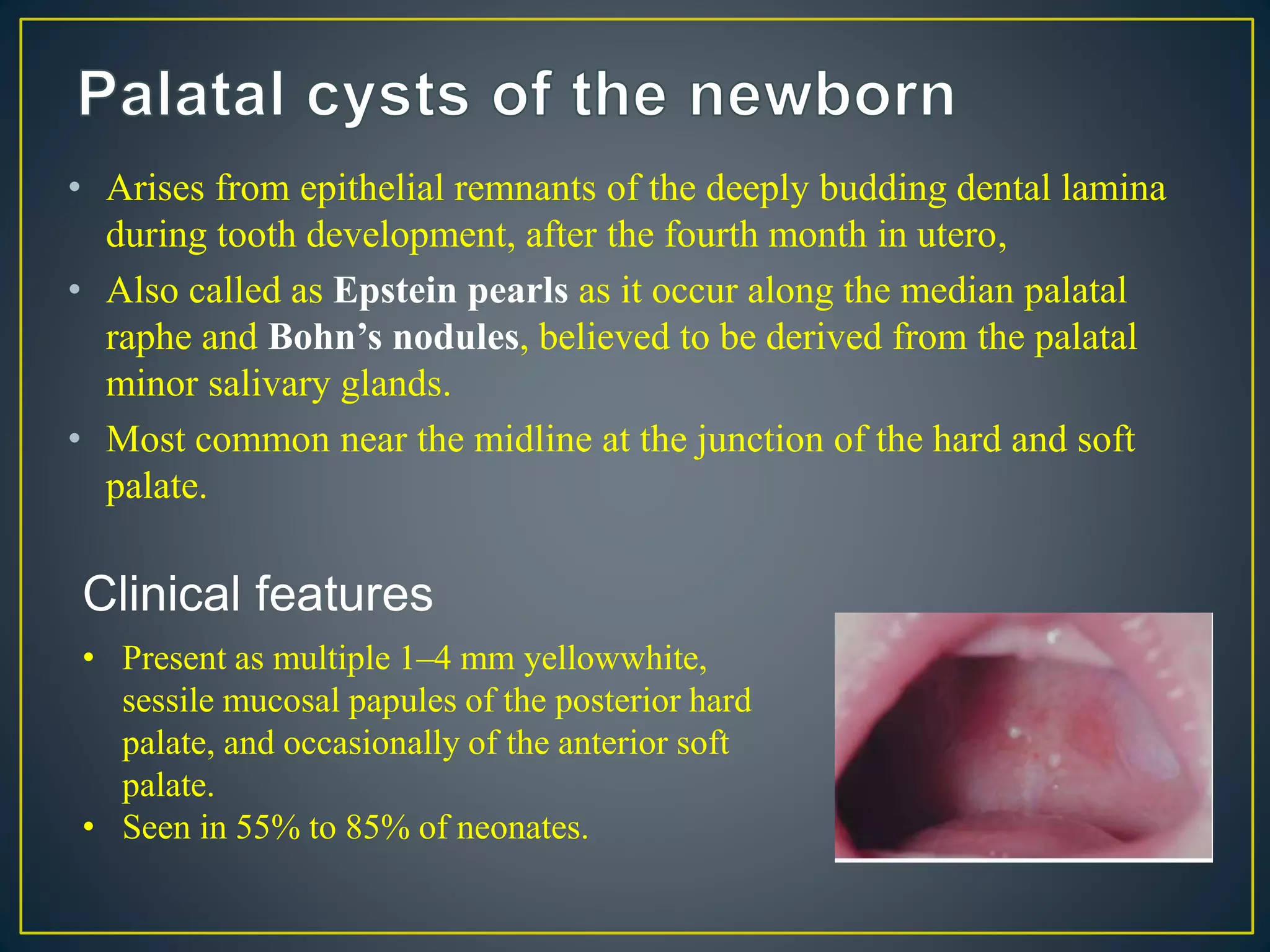 Non odontogenic cyst and pseudo cyst of the jaw- seminar 2- ORIGINAL.pptx