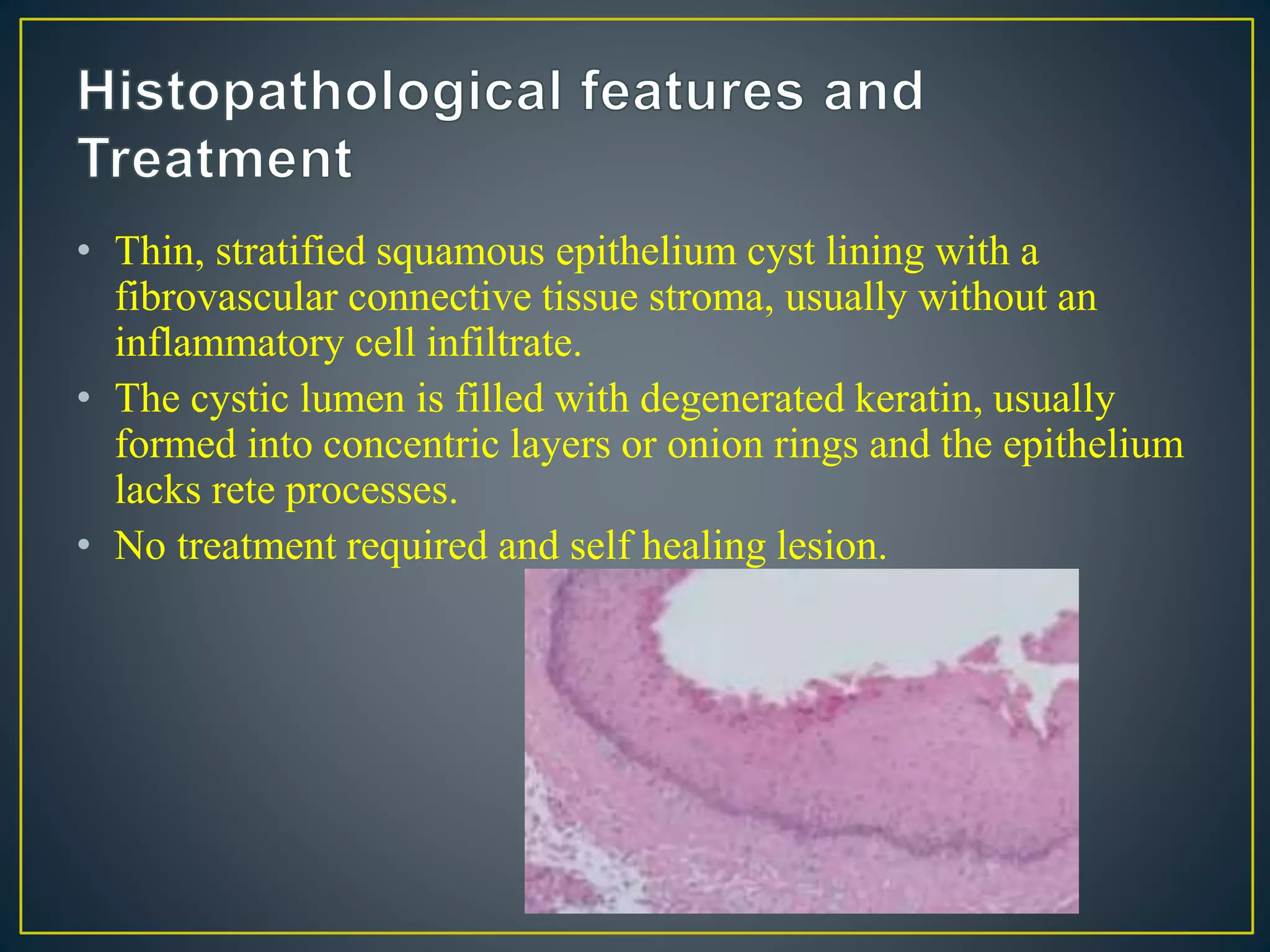 Non odontogenic cyst and pseudo cyst of the jaw- seminar 2- ORIGINAL.pptx