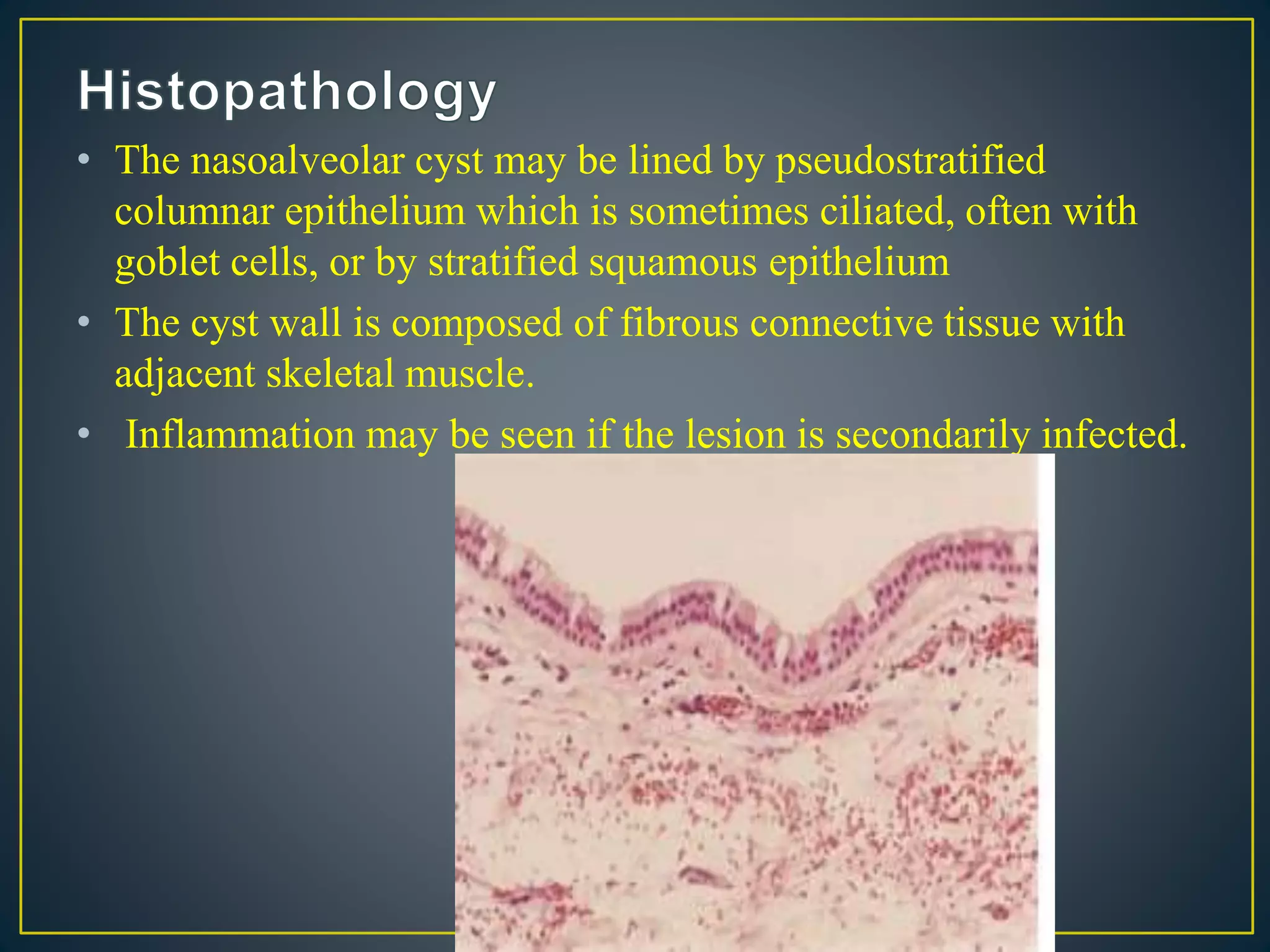 Non odontogenic cyst and pseudo cyst of the jaw- seminar 2- ORIGINAL.pptx