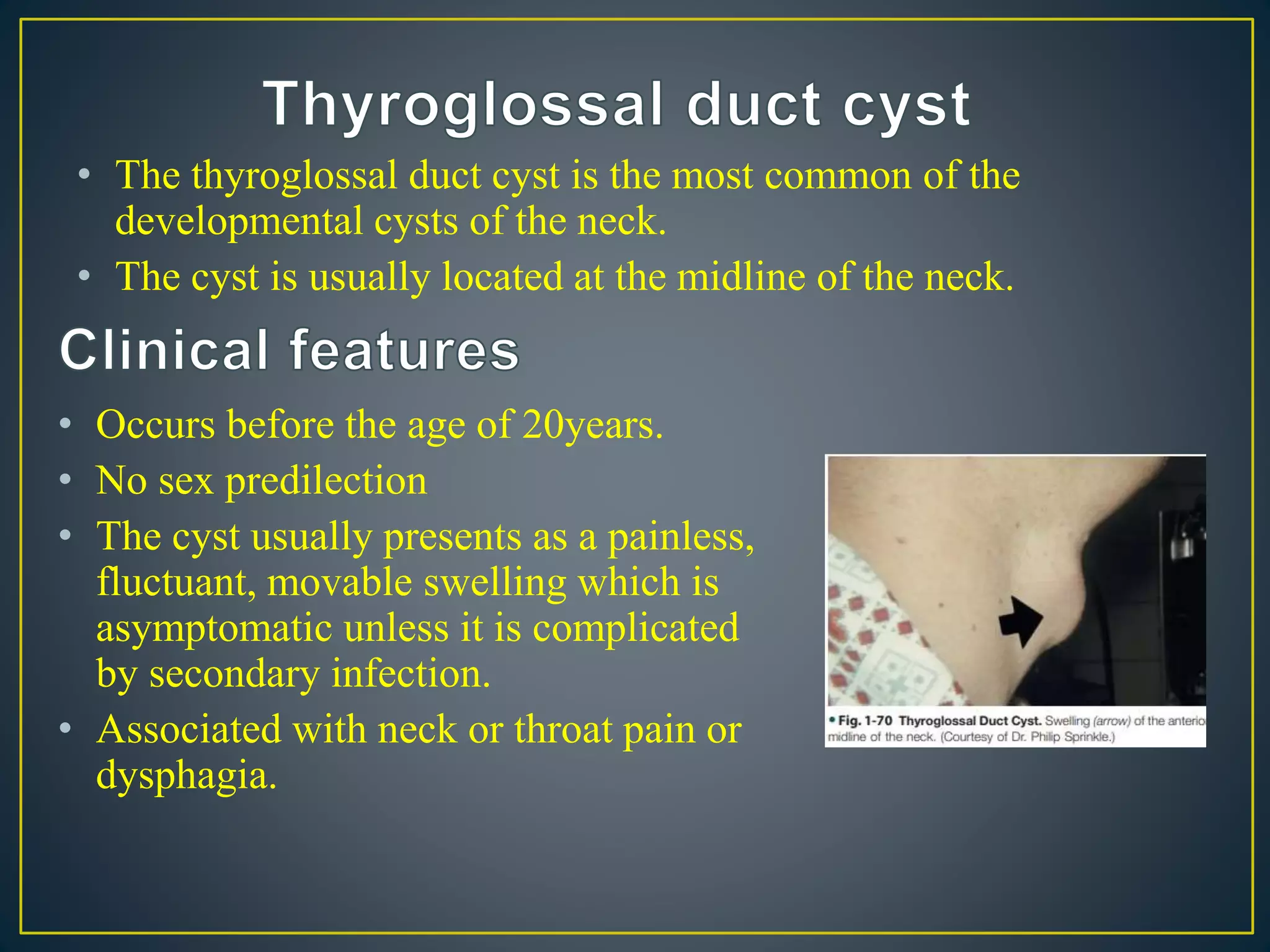 Non odontogenic cyst and pseudo cyst of the jaw- seminar 2- ORIGINAL.pptx