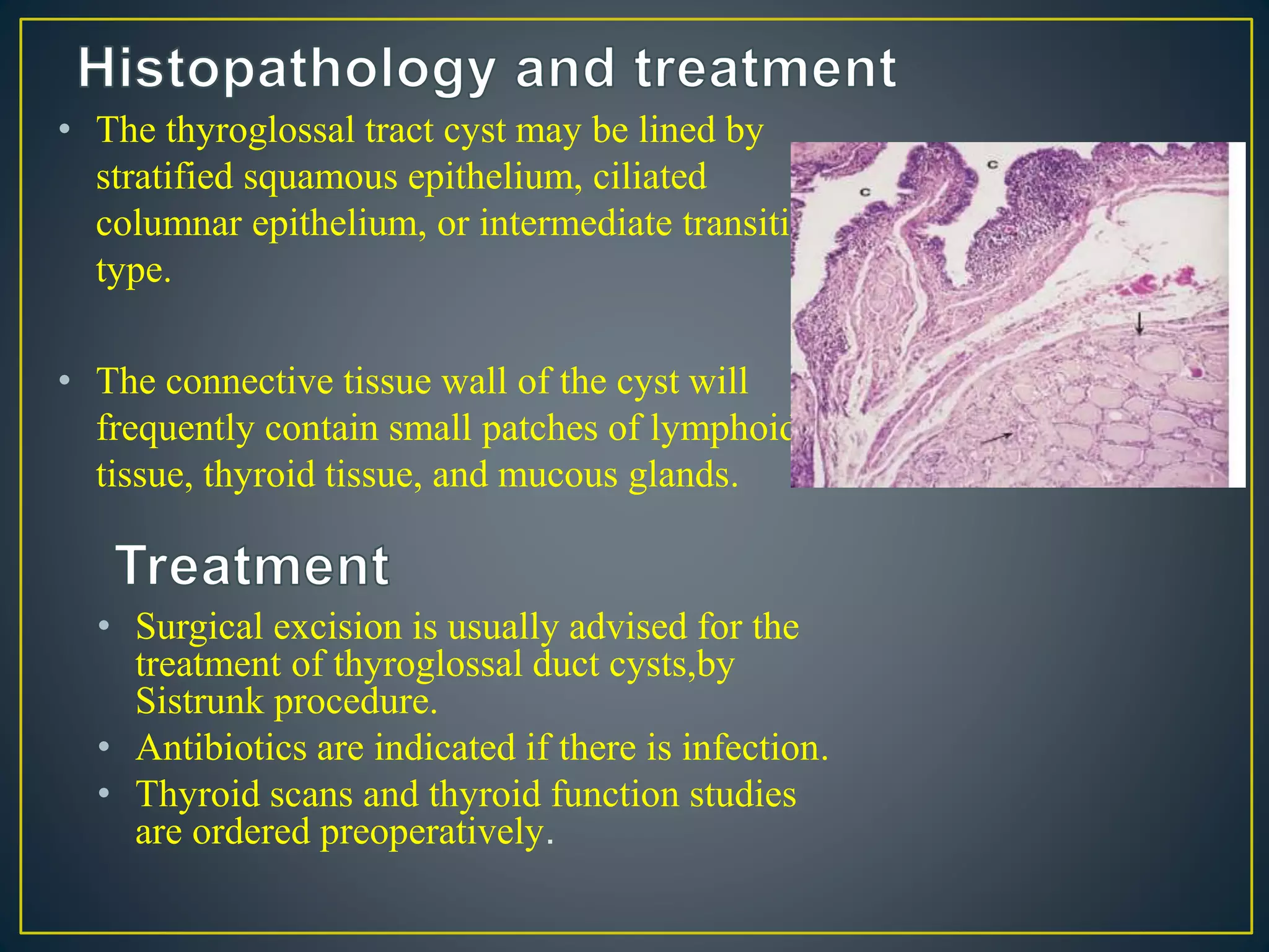 Non odontogenic cyst and pseudo cyst of the jaw- seminar 2- ORIGINAL.pptx