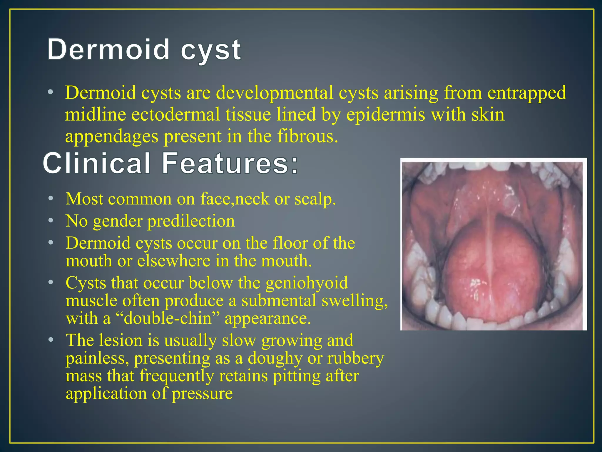 Non odontogenic cyst and pseudo cyst of the jaw- seminar 2- ORIGINAL.pptx