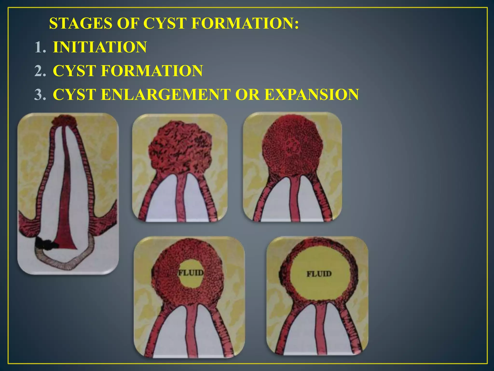 Non odontogenic cyst and pseudo cyst of the jaw- seminar 2- ORIGINAL.pptx