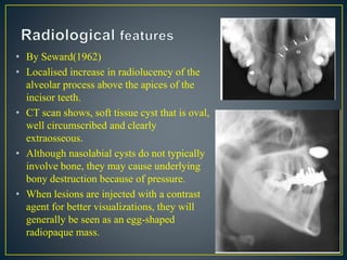 Non odontogenic cyst and pseudo cyst of the jaw- seminar 2- ORIGINAL.pptx