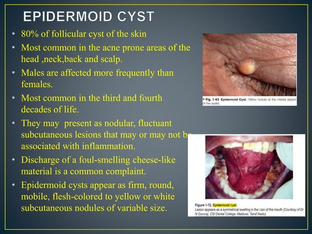 Non odontogenic cyst and pseudo cyst of the jaw- seminar 2- ORIGINAL ...