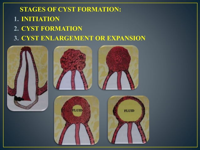 Non odontogenic cyst and pseudo cyst of the jaw- seminar 2- ORIGINAL ...