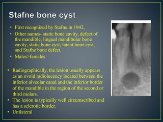 Non odontogenic cyst and pseudo cyst of the jaw- seminar 2- ORIGINAL.pptx